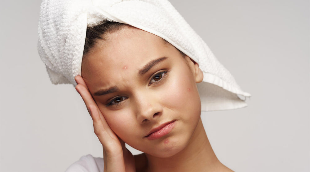 3 reasons your skin is breaking out - BASK™